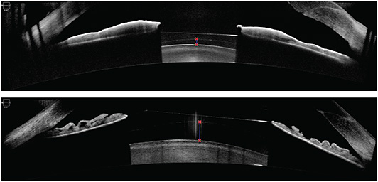 Corneal Physician | PentaVision