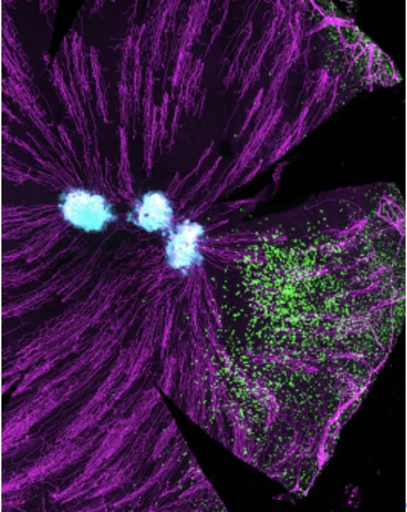 Corneal Physician | PentaVision
